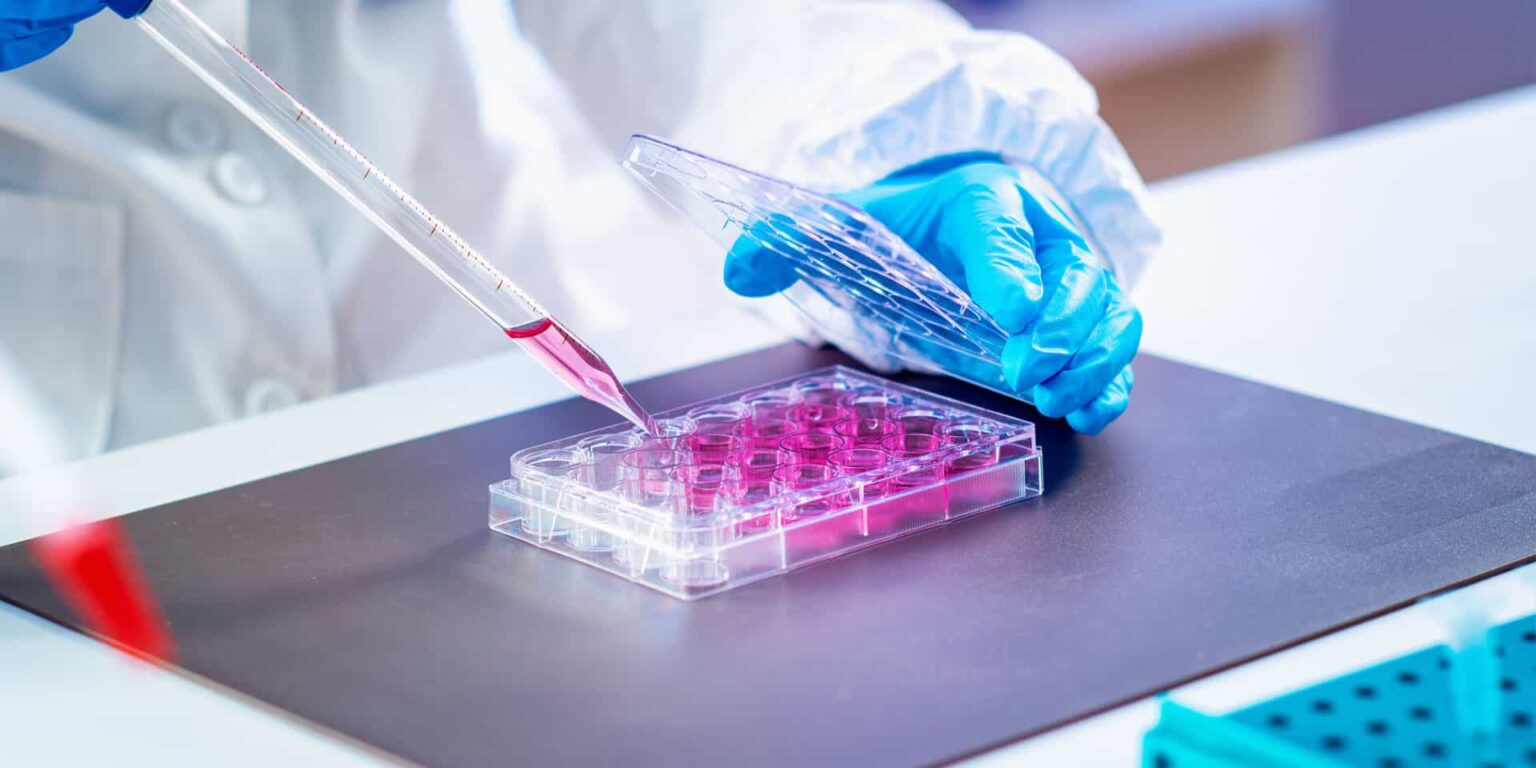 Gender Sex Selection North Cyprus Ivf